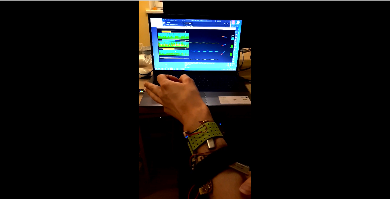 uMyo - wearable EMG sensor – uDevices